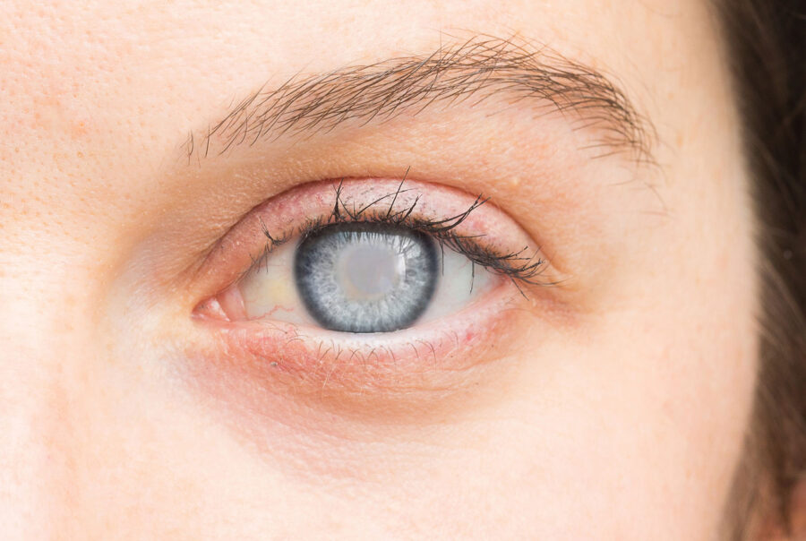 TK&S Optometrists | Specialist Opticians Northampton